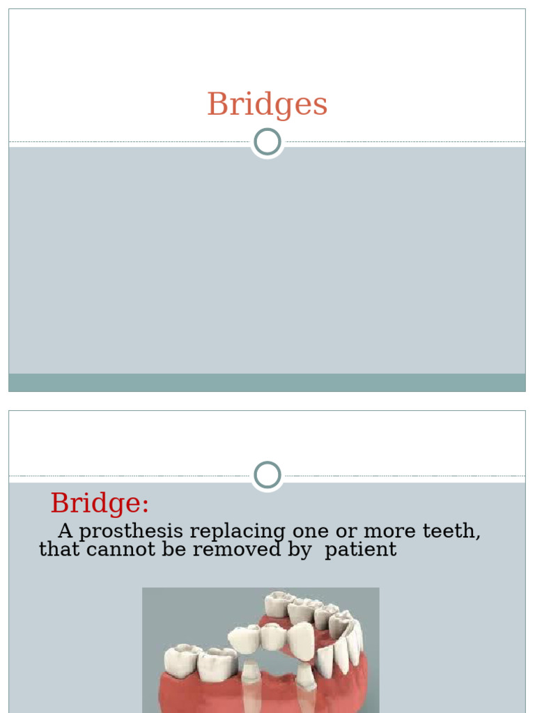 6 Bridges Introduction | PDF