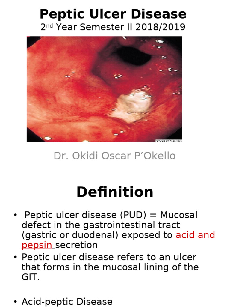 Peptic Ulcer Disease: 2 Year Semester II 2018/2019 | PDF ...