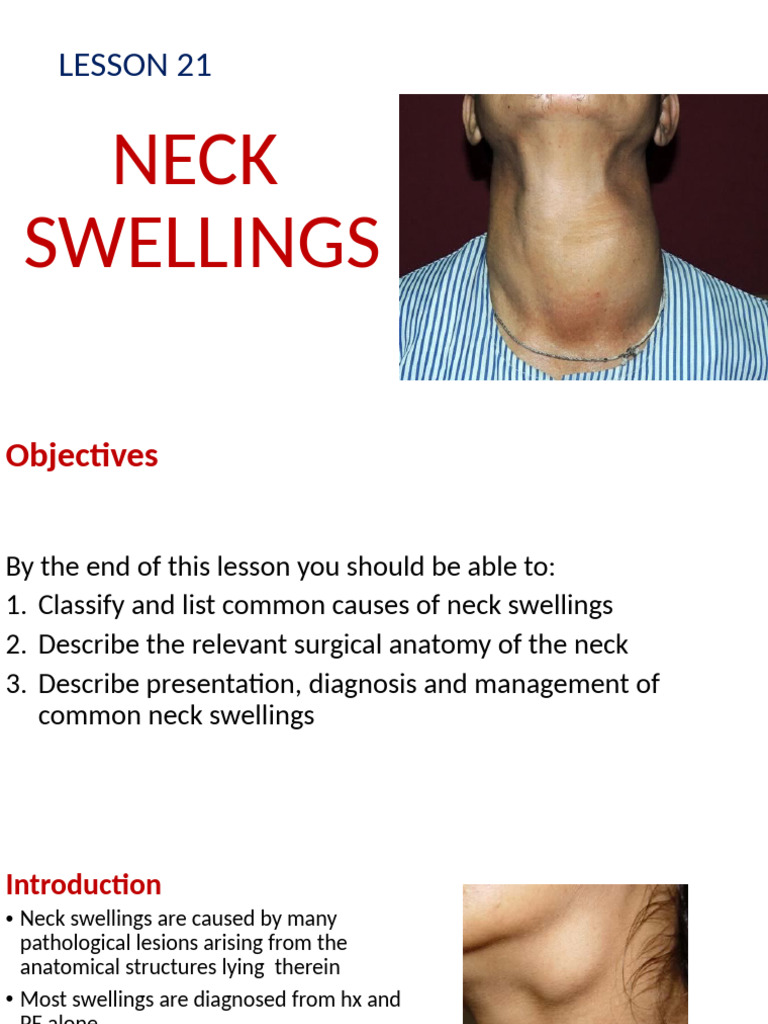 Lesson 21 - Neck Swellings | PDF