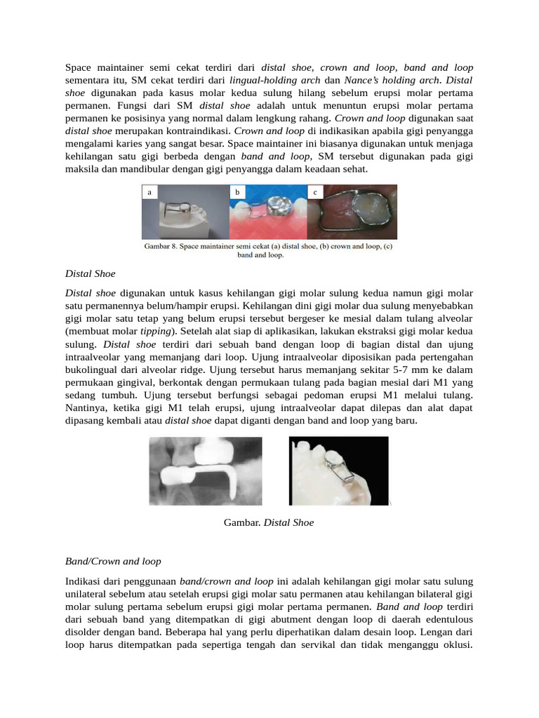 SM Semi Fixed | PDF