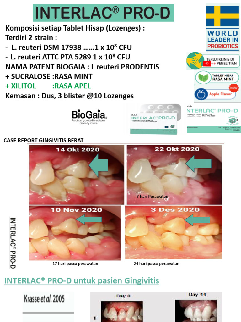 Kasus - Before After - Interlac Pro D | PDF