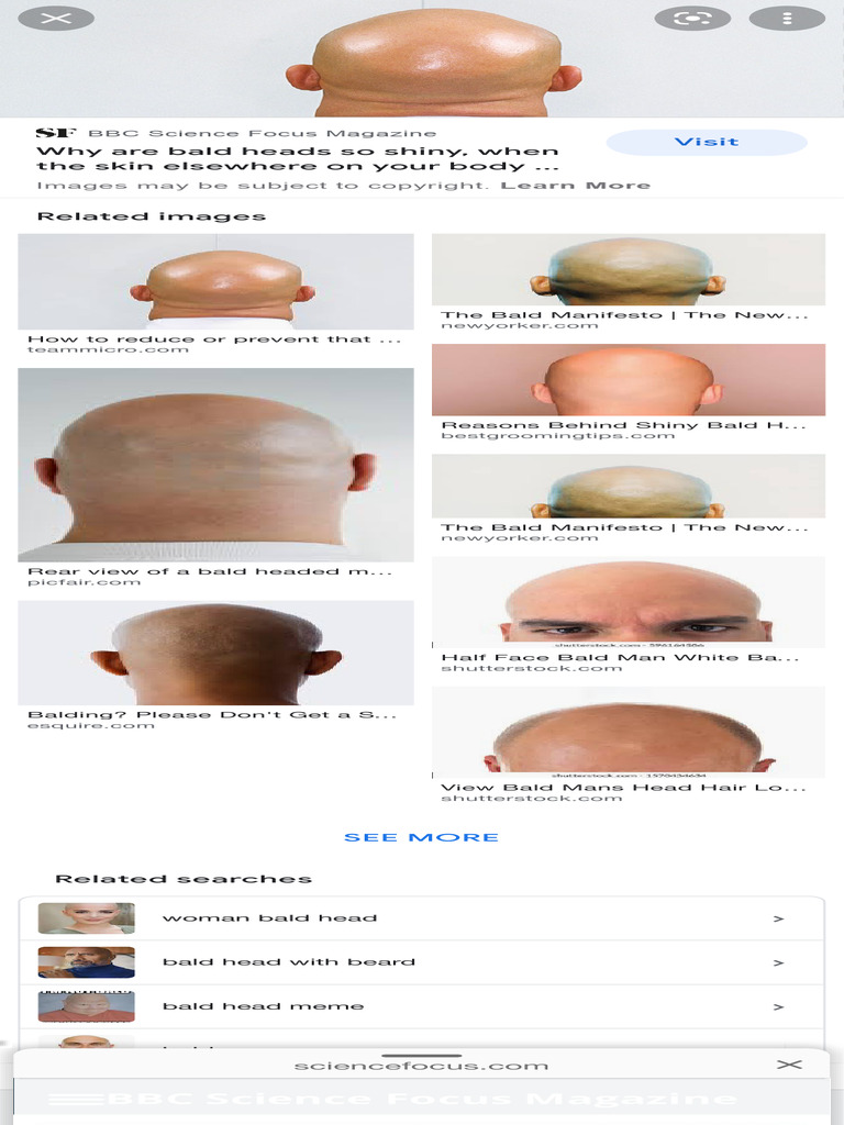 Bald - Google Search | PDF