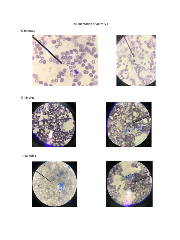Documentation Of Activity 4 Pdf
