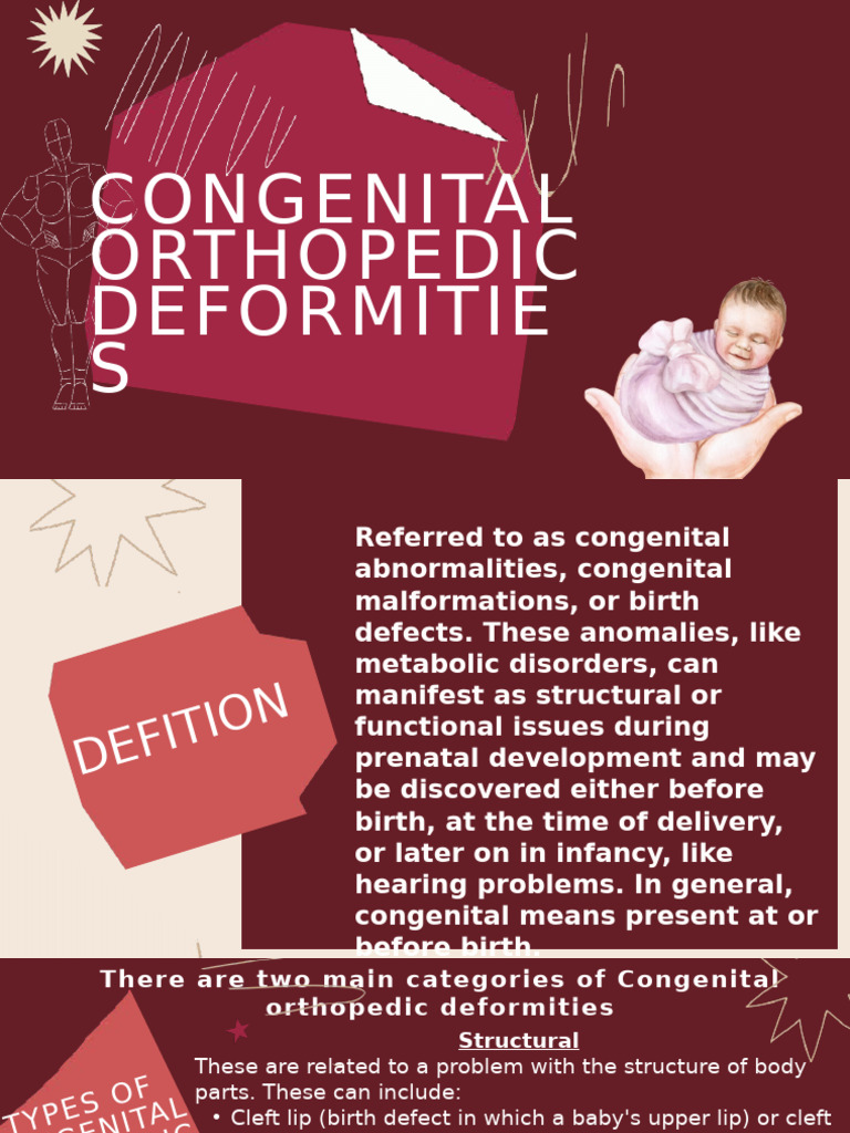 Congenital Orthopedic Deformities | PDF