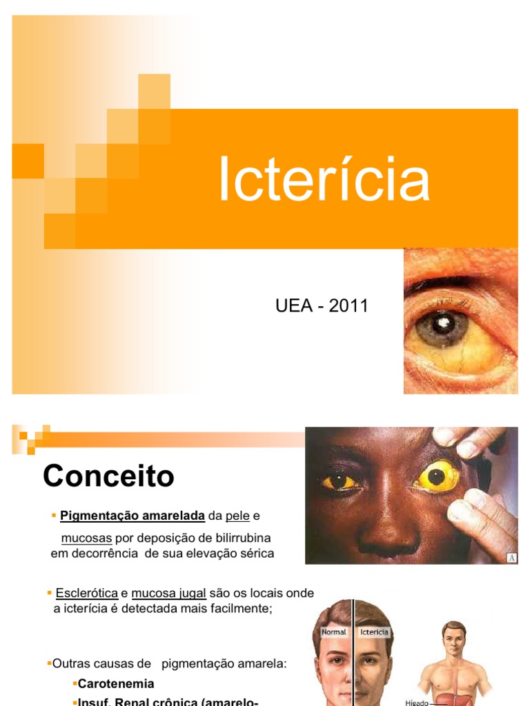 Ictericia | PDF | Gastroenterologia | Especialidades médicas