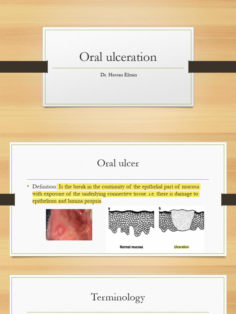 Oral ulceration | PDF