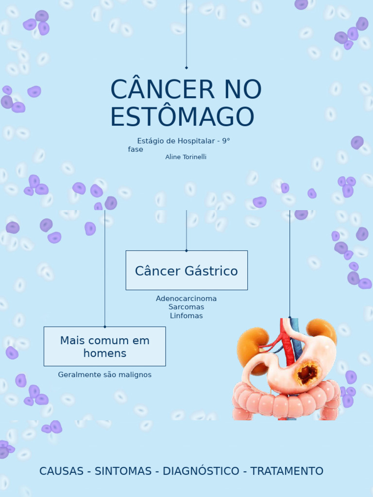 Câncer de Estomâgo | PDF
