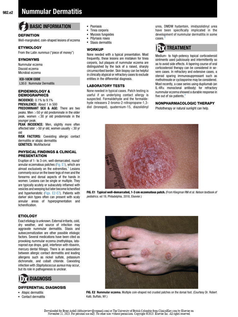 Numular Dermatitis | PDF
