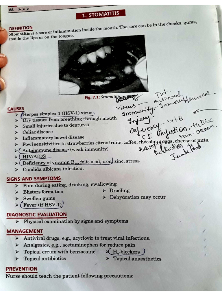 Stomatitis Glossitis GERD | PDF