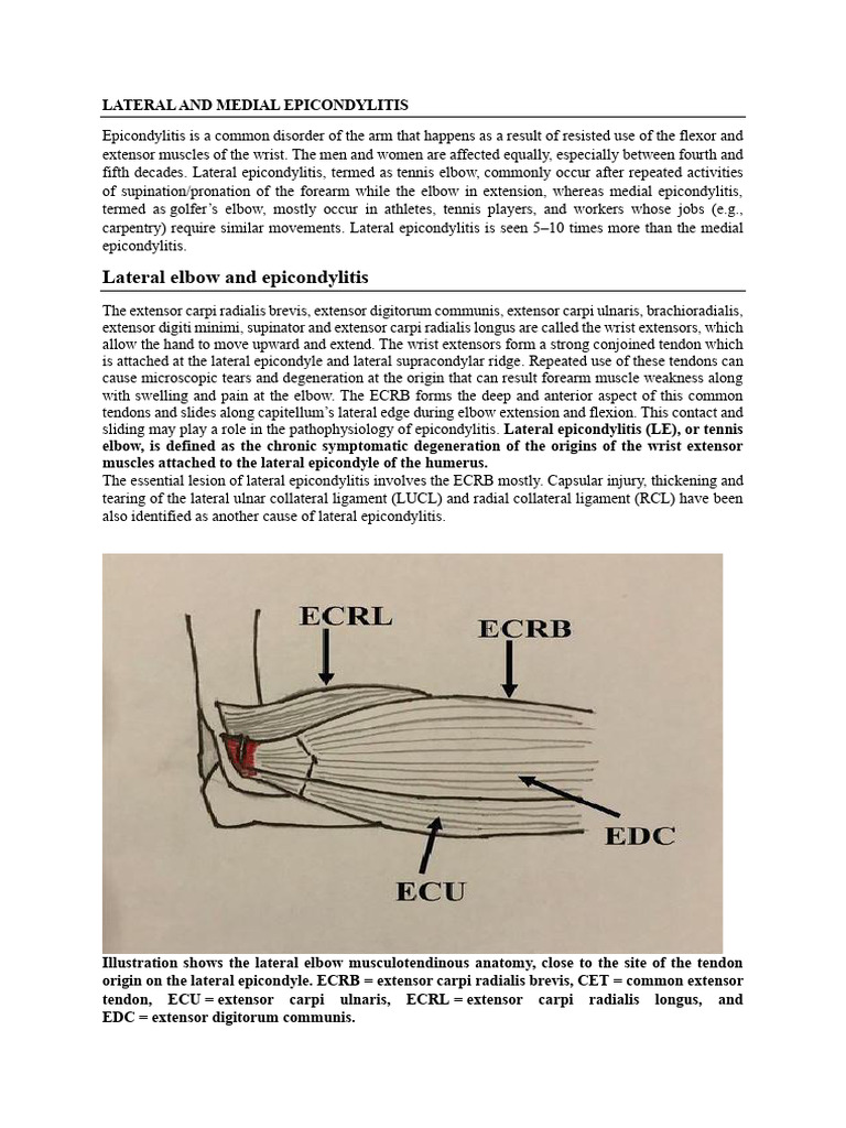 Lateral and Medial Epicondylitis | PDF