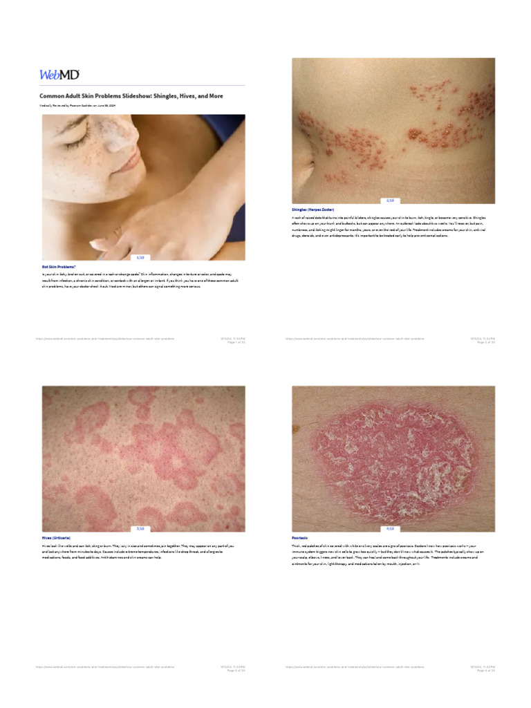 Pictures of Common Adult Skin-Problems - Identify Rashes, Eczema and ...