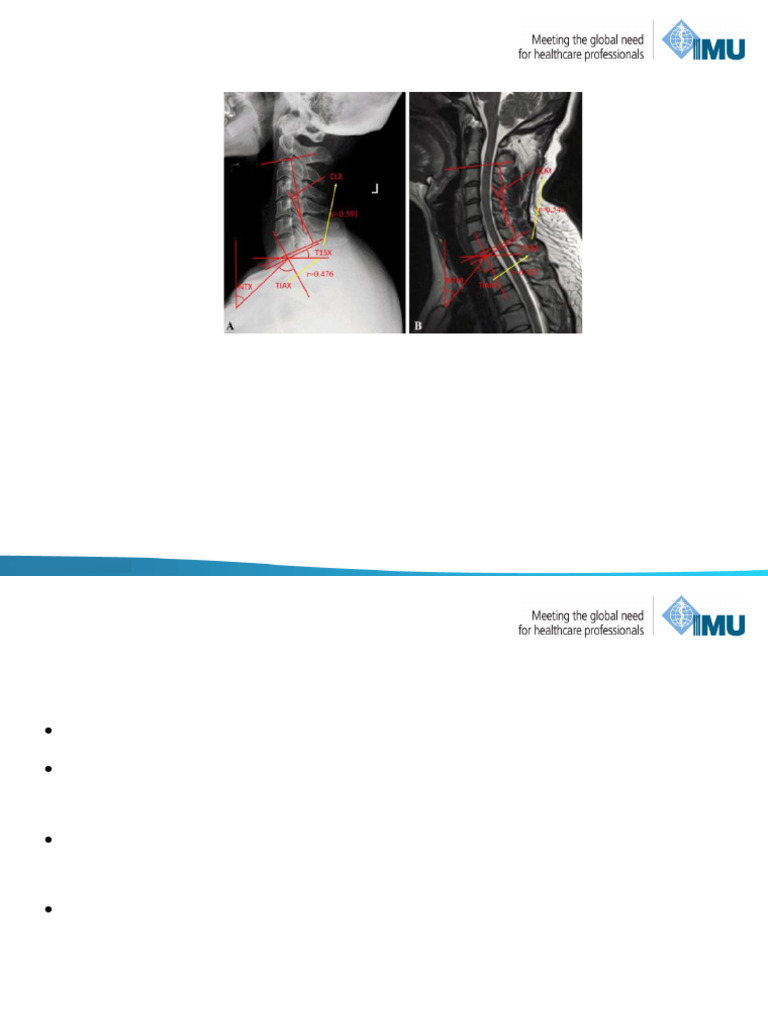 Radiographic Imaging Measurement | PDF