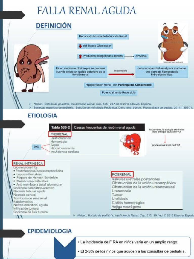 Falla Renal Aguda Pediatrica - 20240529 - 090709 | PDF