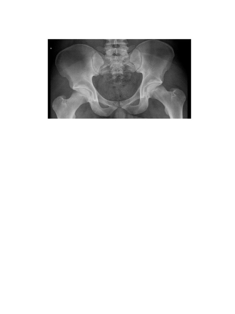 Imprimir Pelvis AP Sacro Coxis Laterl 1 | PDF