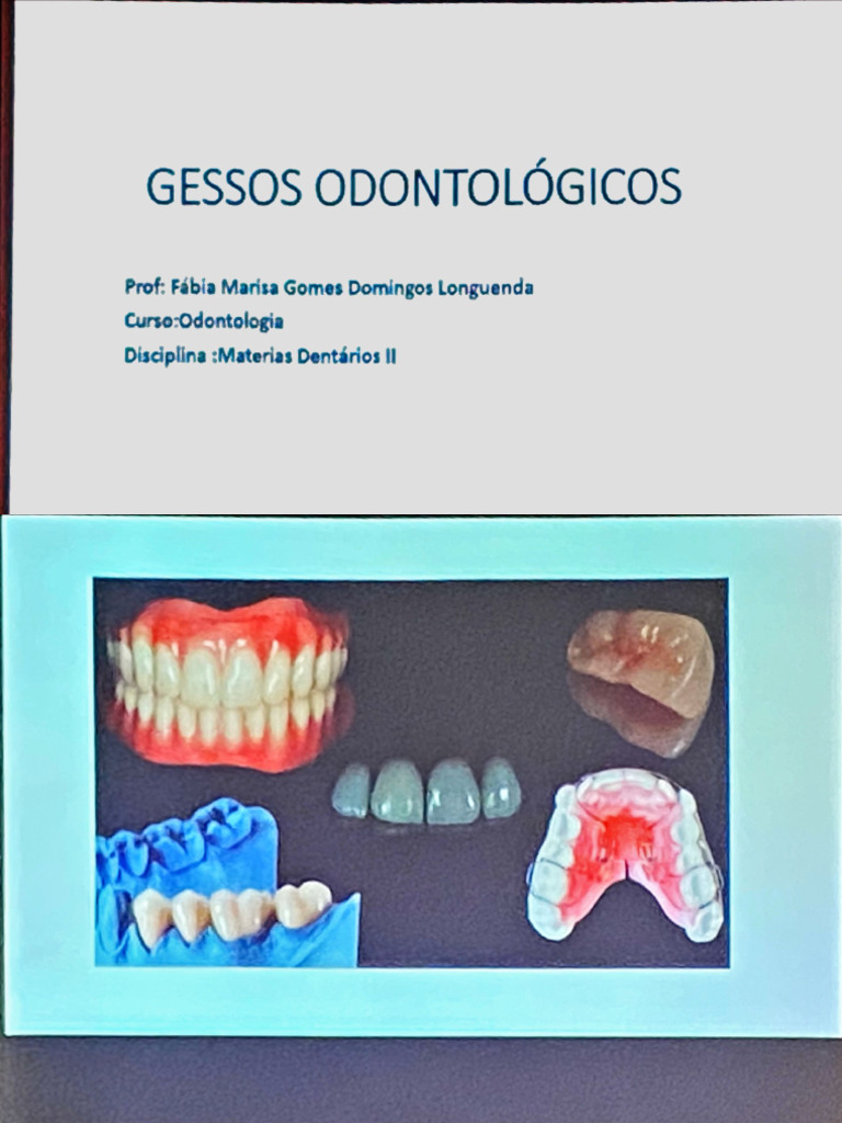 Gesso Odontológico | PDF