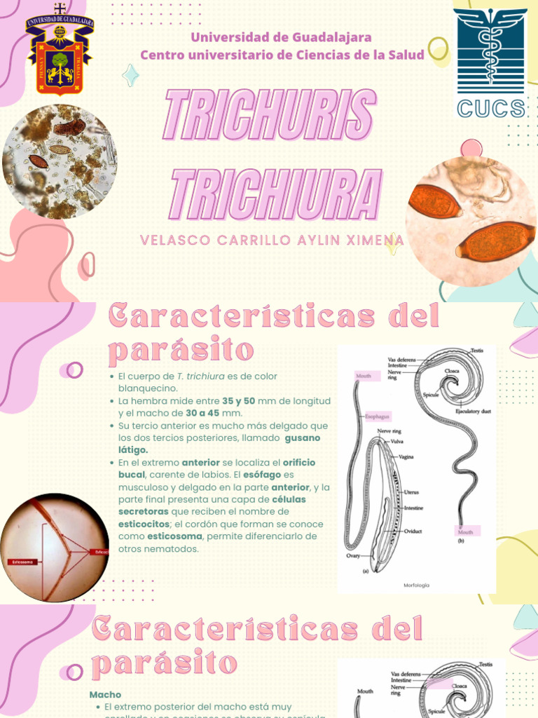 Trichuris trichiura-AXVC | PDF | Gastroenterology | Science & Mathematics