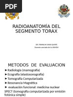 Radiografía de Tórax Normal - Patrón Intersticial | PDF | Pulmón | Tórax