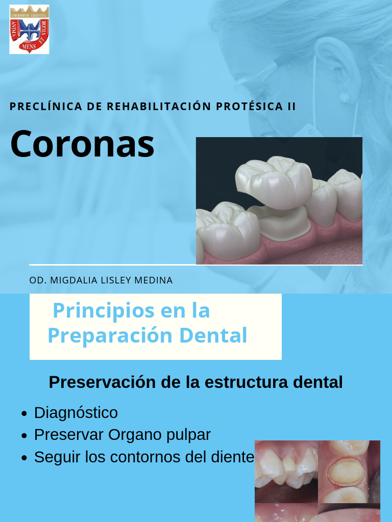 Coronas II | PDF