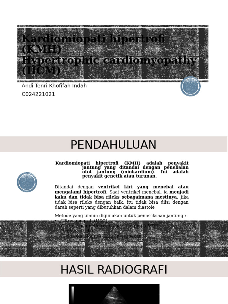 Kardiomiopati Hipertrofi (KMH) | PDF