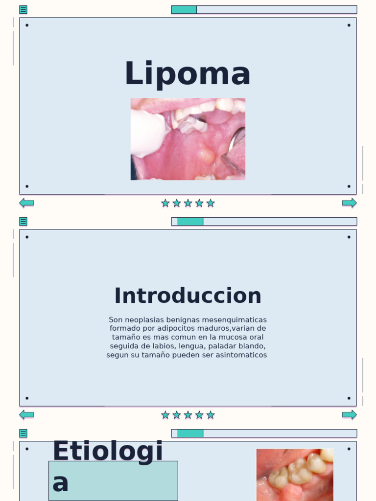 Lipoma | PDF