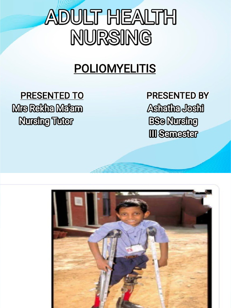Poliomyelitis 7 | PDF