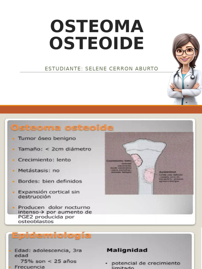 Osteoma Osteoide | PDF