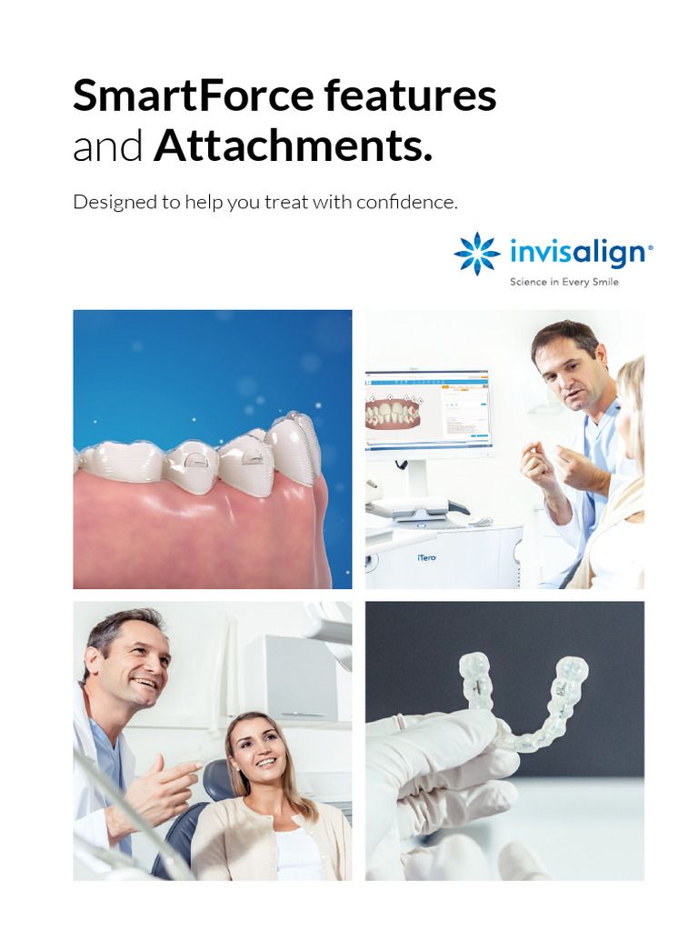 SmartForce Features and Attachments - En-Gb-En | PDF