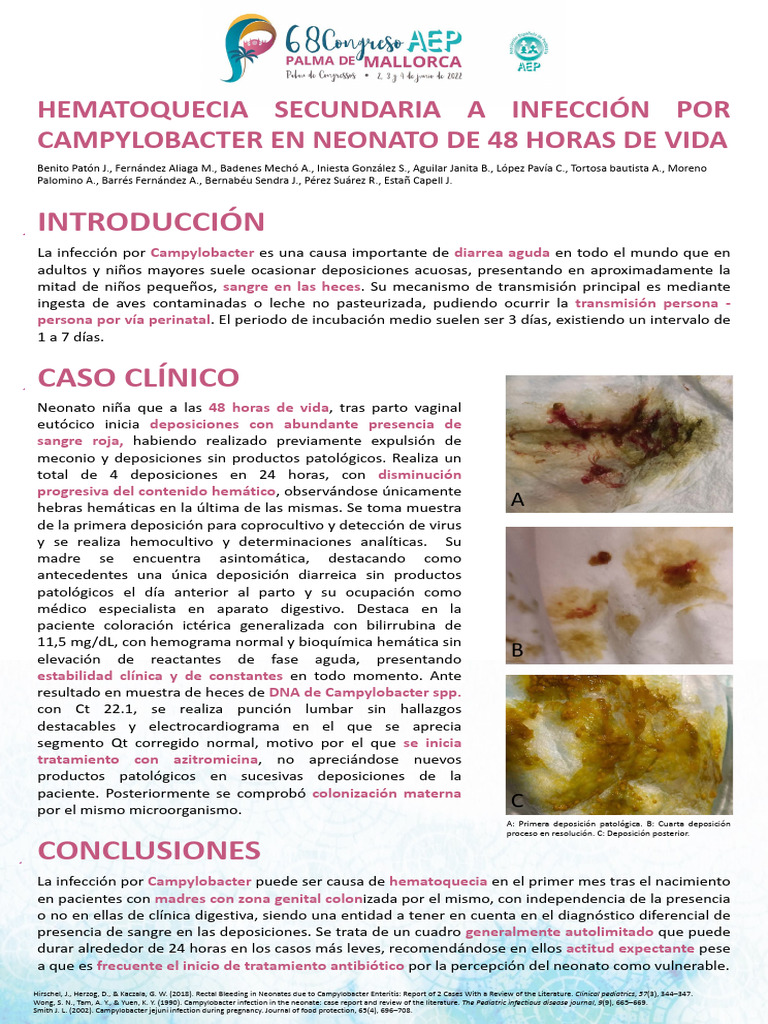 Hematoquecia Secundaria A Infección Por Campylobacter en Neonato de 48 ...