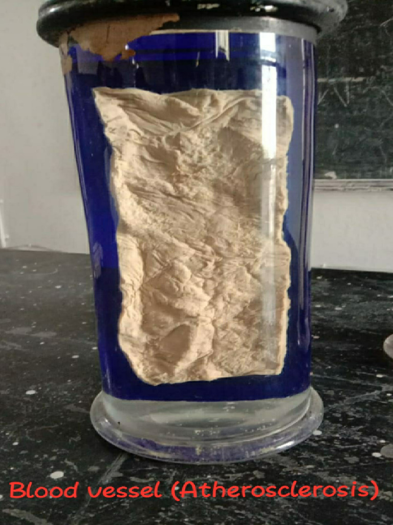 Patho Specimen | PDF