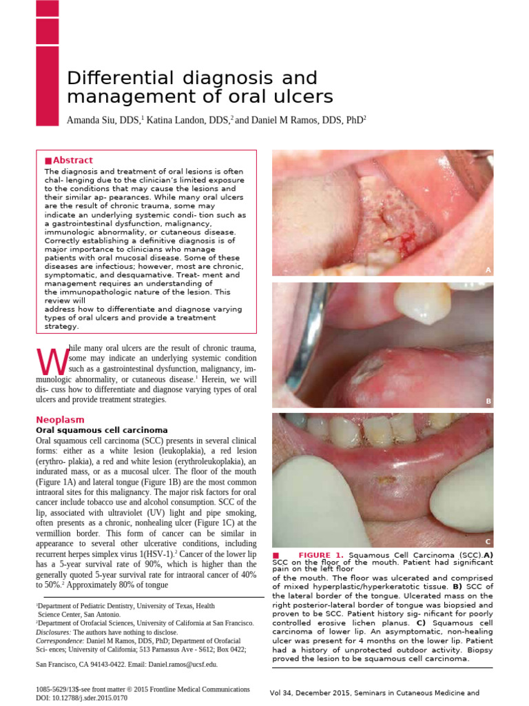 SCMS V34i4 Differential Diagnosis and Management of Oral Ulcers | PDF