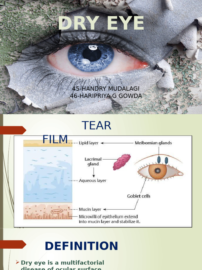 DRY EYE PPT 3 | PDF