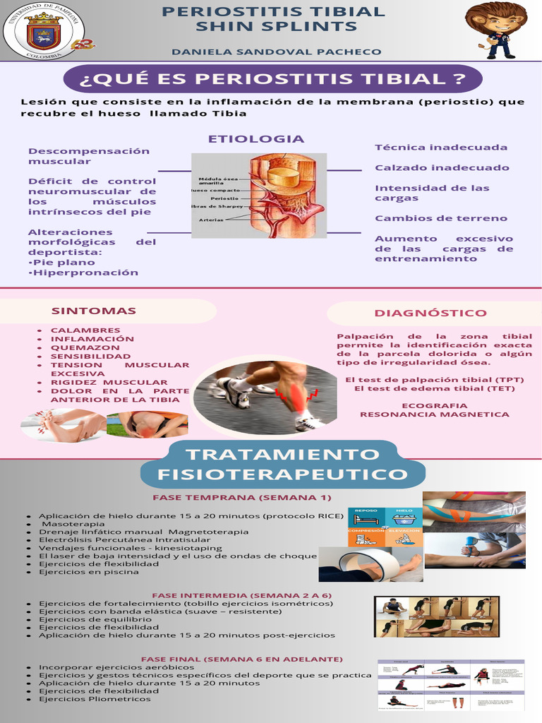 Infografía PERIOSTITIS TIBIAL | PDF