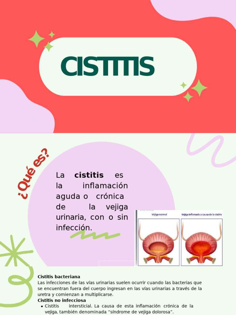 Cistitis | PDF