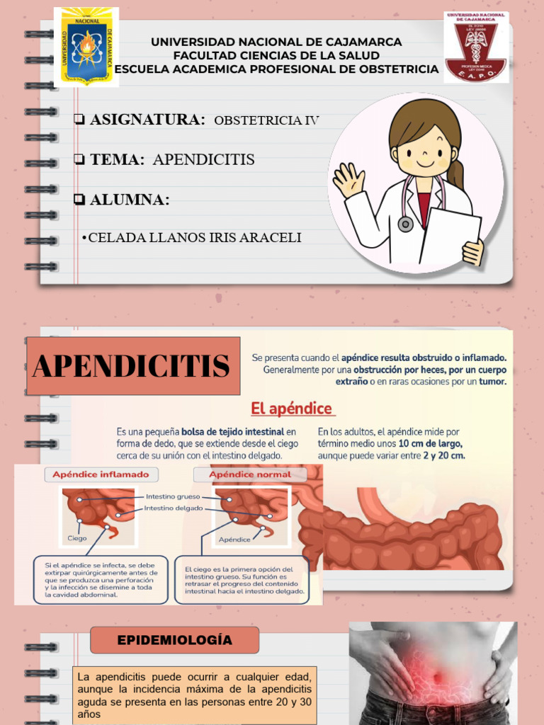 Apendicitis | PDF