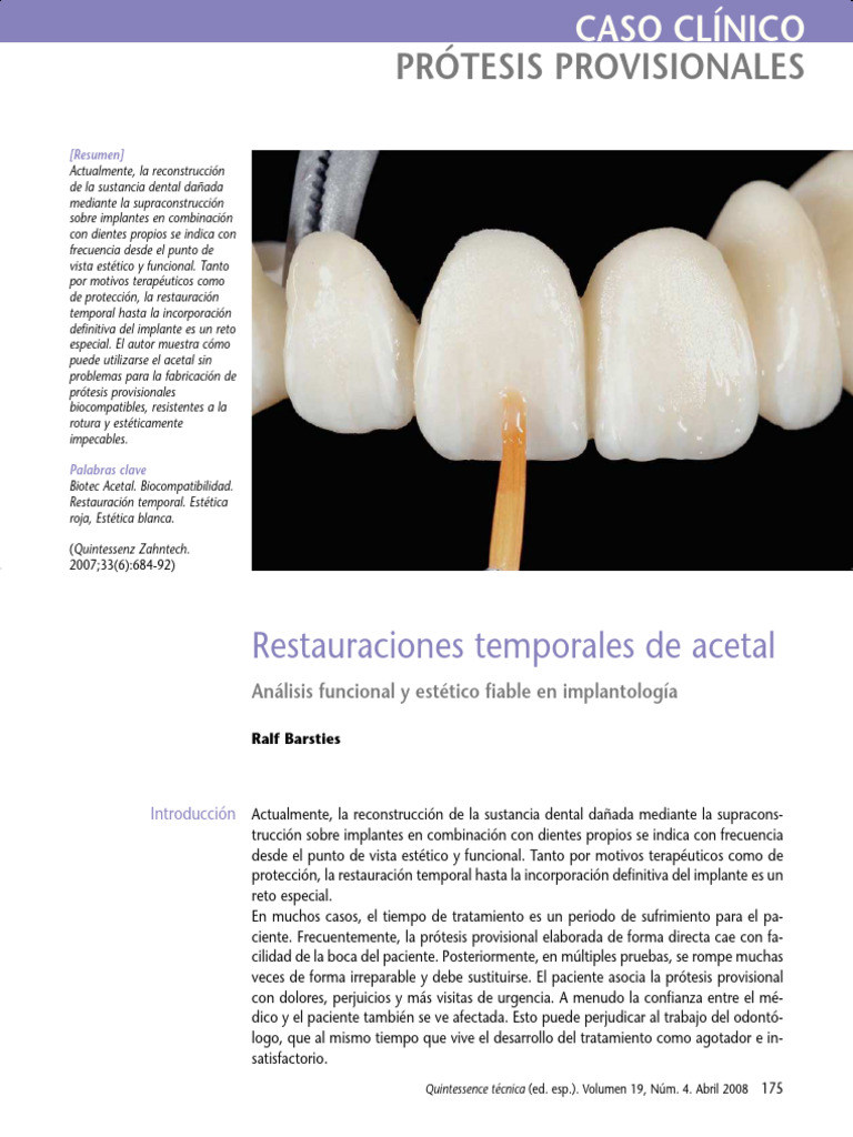 Prótesis Provisionales: Caso Clínico | PDF