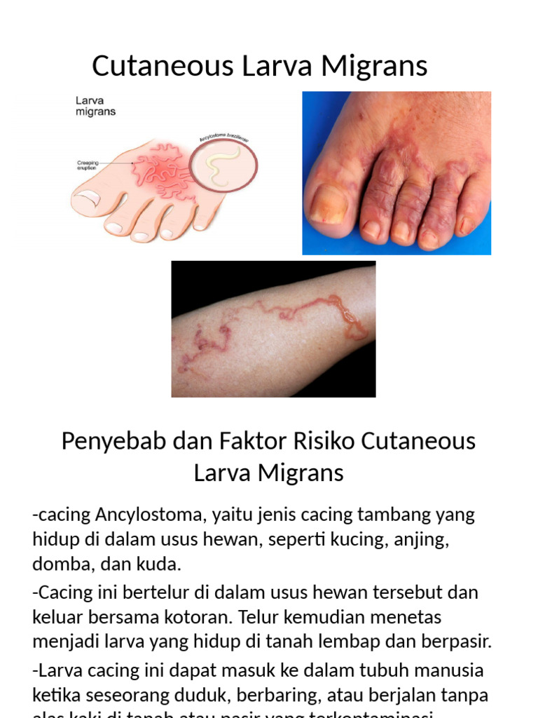 Cutaneous Larva Migrans | PDF