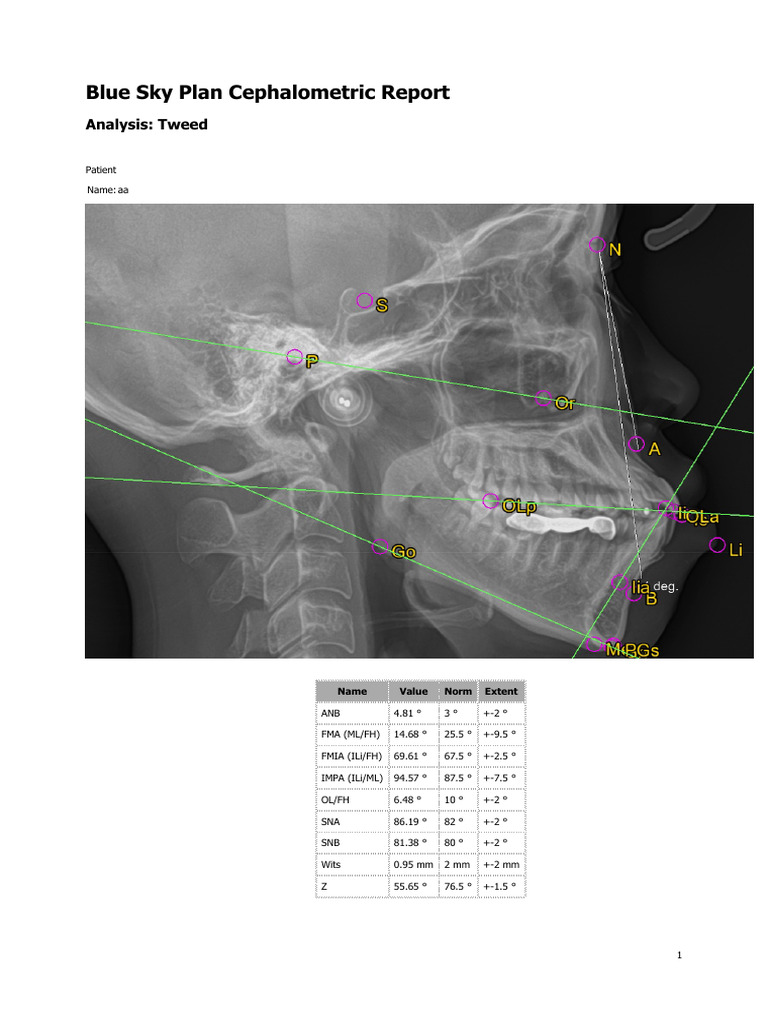 Cephalometric Analysis Report: Tweed | PDF