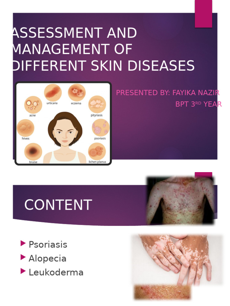 Management of Skin Diseases Overview | PDF | Psoriasis | Wellness