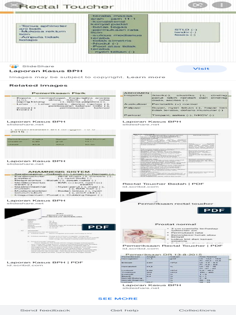 rectal touche bph | PDF