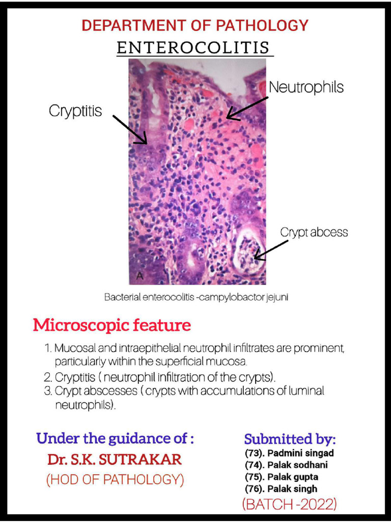 Enterocolitis | PDF