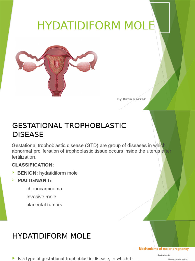 Hydatidiform Mole | PDF