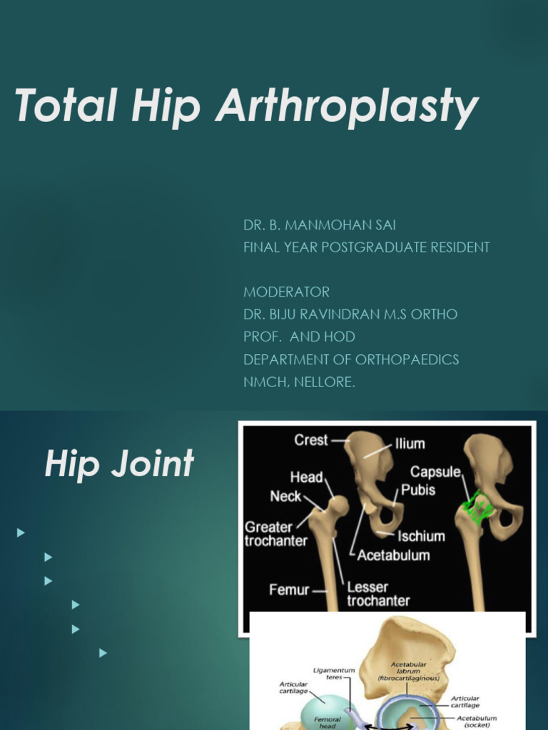 Total Hip Replacement | PDF | Hip | Medical Specialties