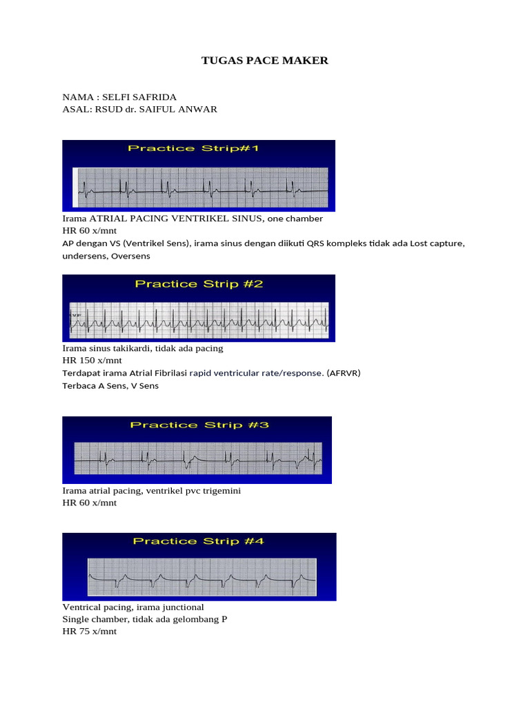 Pace Maker SELFI | PDF