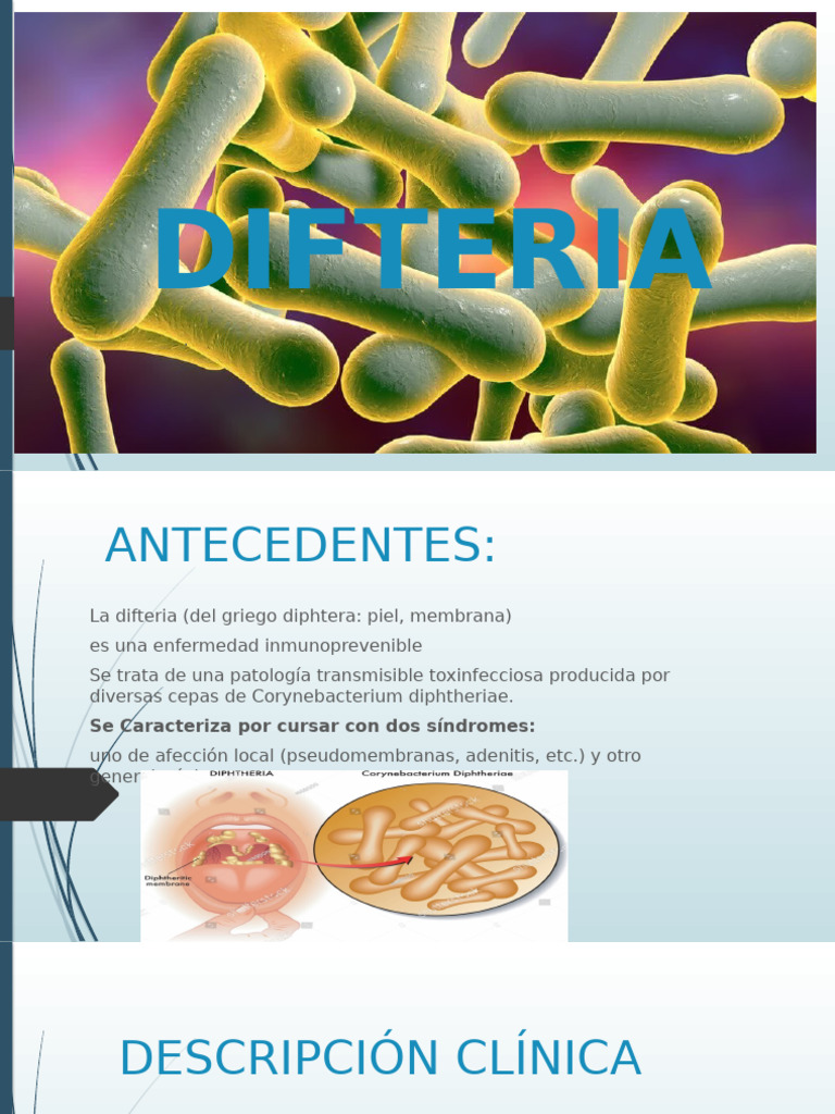 Difteria 2 | PDF