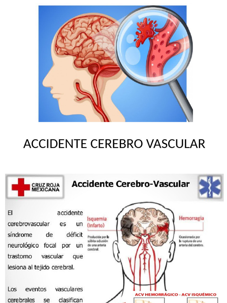 ACCIDENTE CEREBRO VASCULAR | PDF