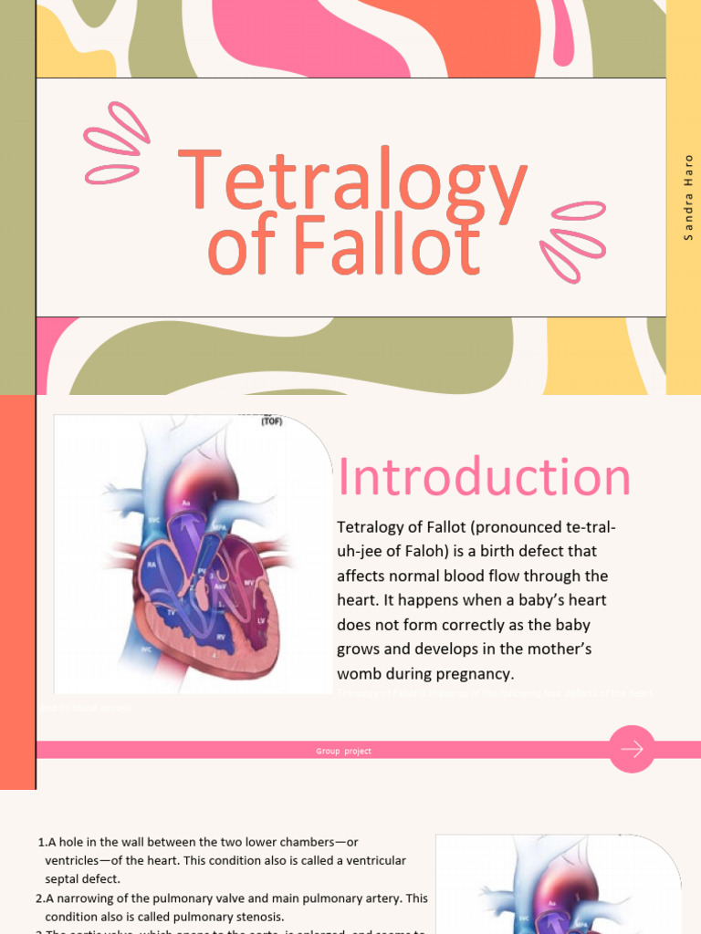 Tetralogy of Fallot | PDF