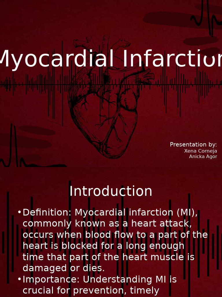 Myocardial Infarction Presentation-1 | PDF