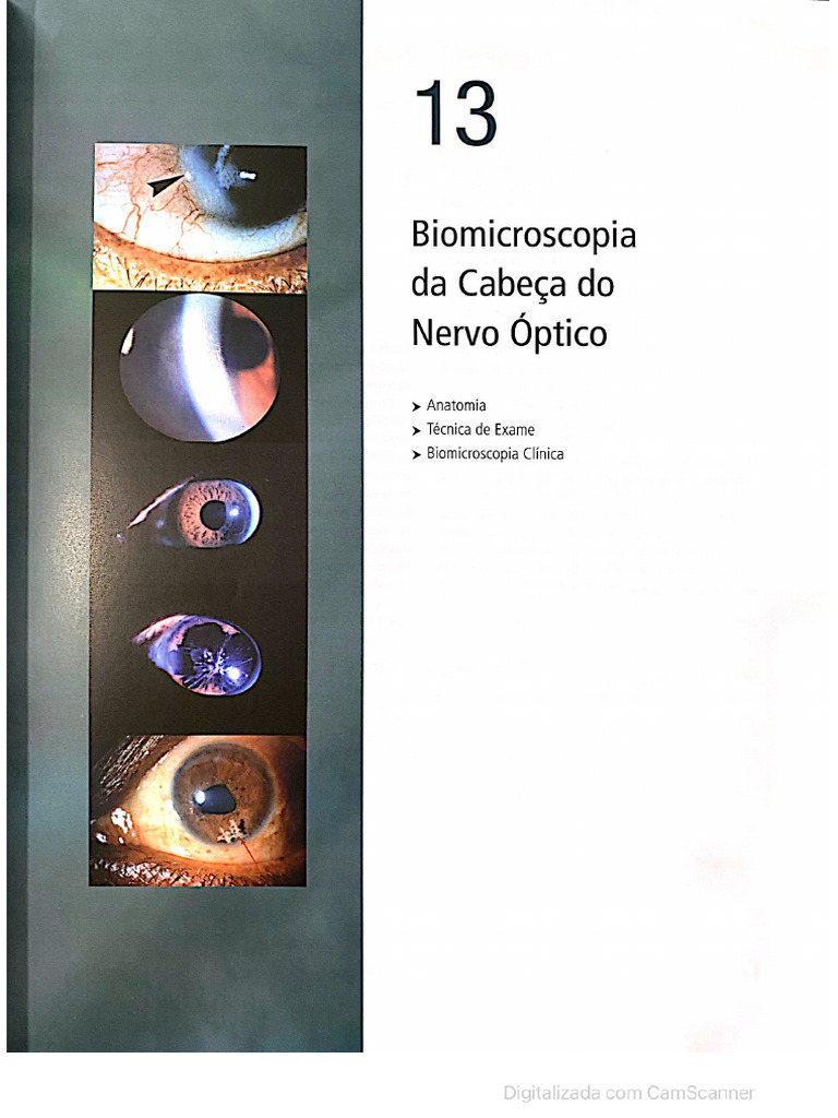 Biomicroscopia Cap 13-16 | PDF