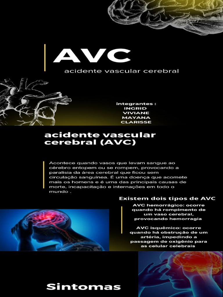 AVC | PDF