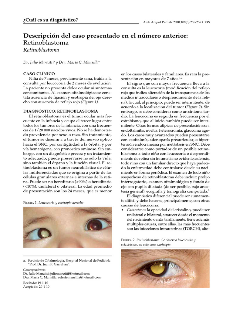 Retinoblastoma | PDF